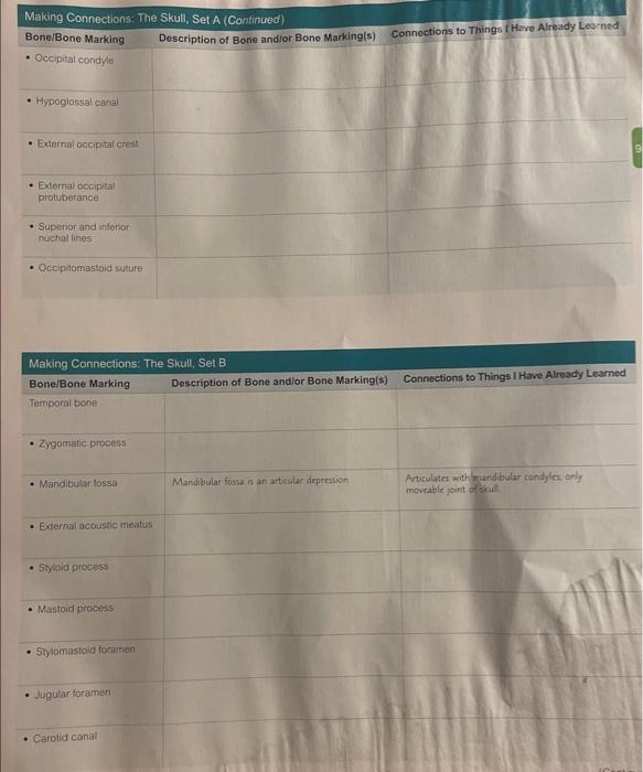 Solved Making Connections: The Skull, Set A Bone/Bone | Chegg.com