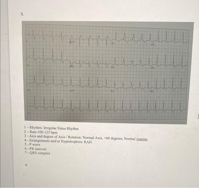 3. الالالا VR Vi VA mooh DI VL V5 M VF V3 VG 1 - | Chegg.com