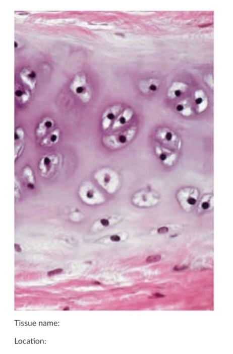 Solved Tissue Name: Tissue Location (only 1): Tissue | Chegg.com