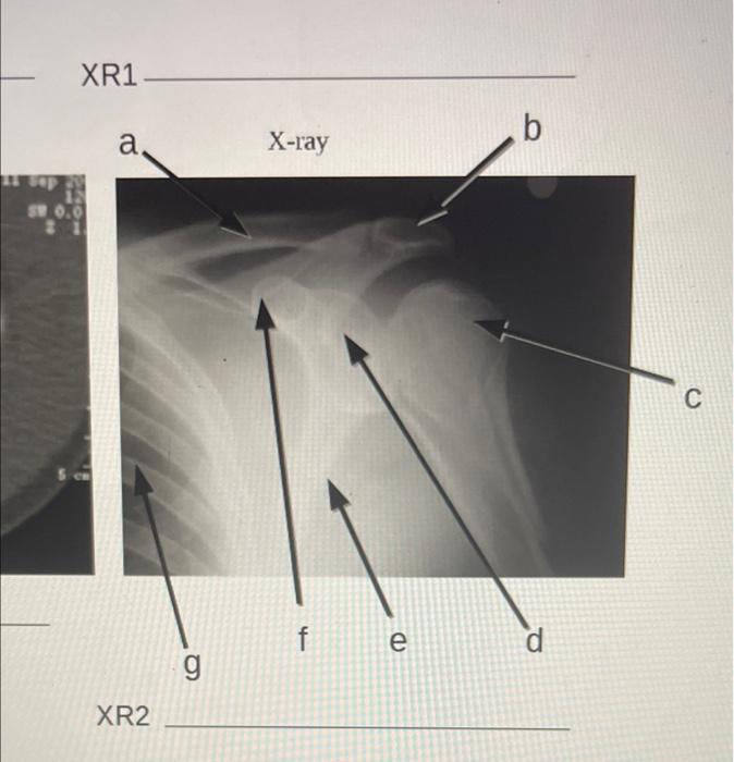 Solved XR1 X-ray b a 19 SH0.0 с f e d g XR2 | Chegg.com