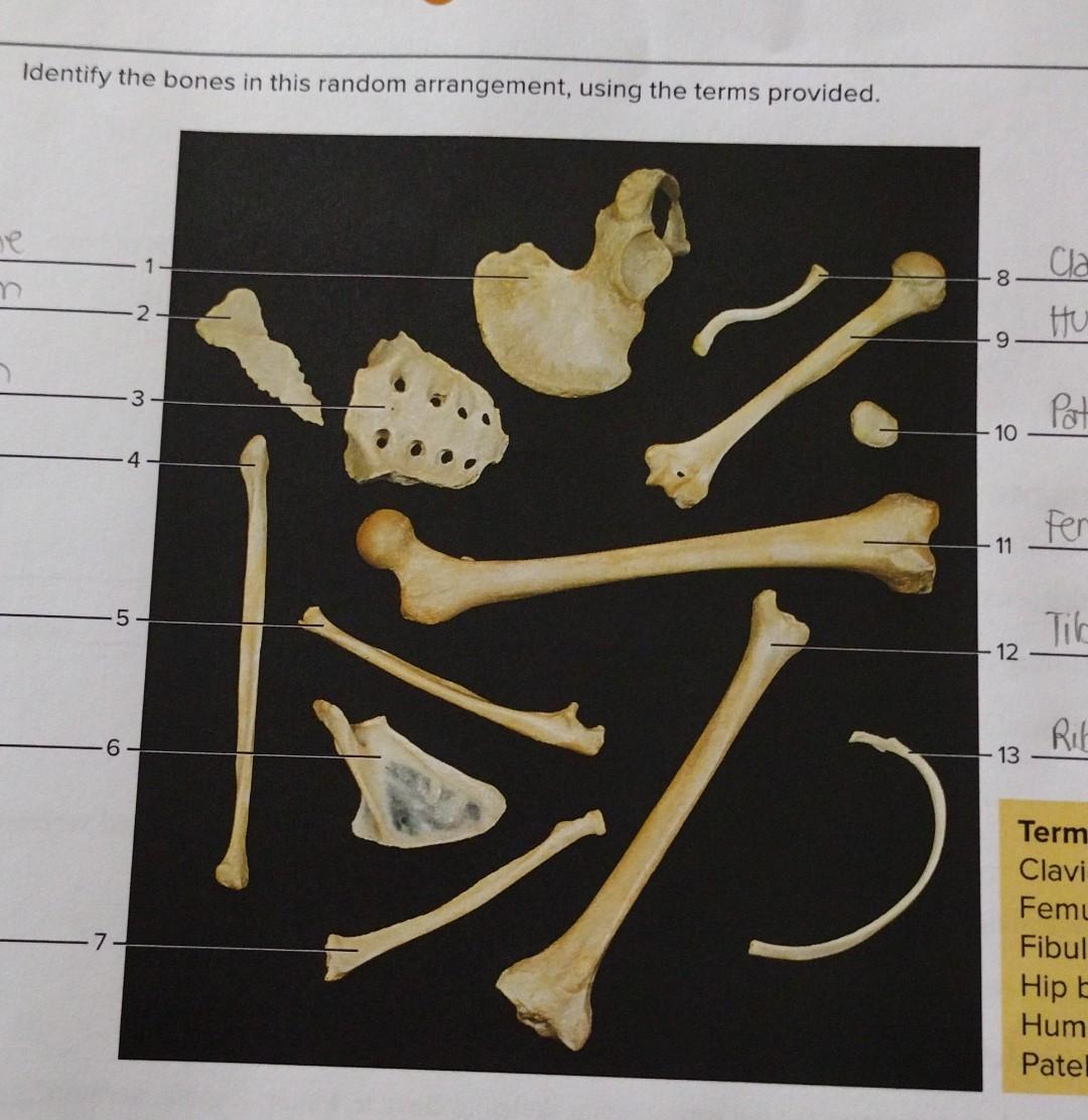 Solved Identify the bones in this random arrangement, using | Chegg.com