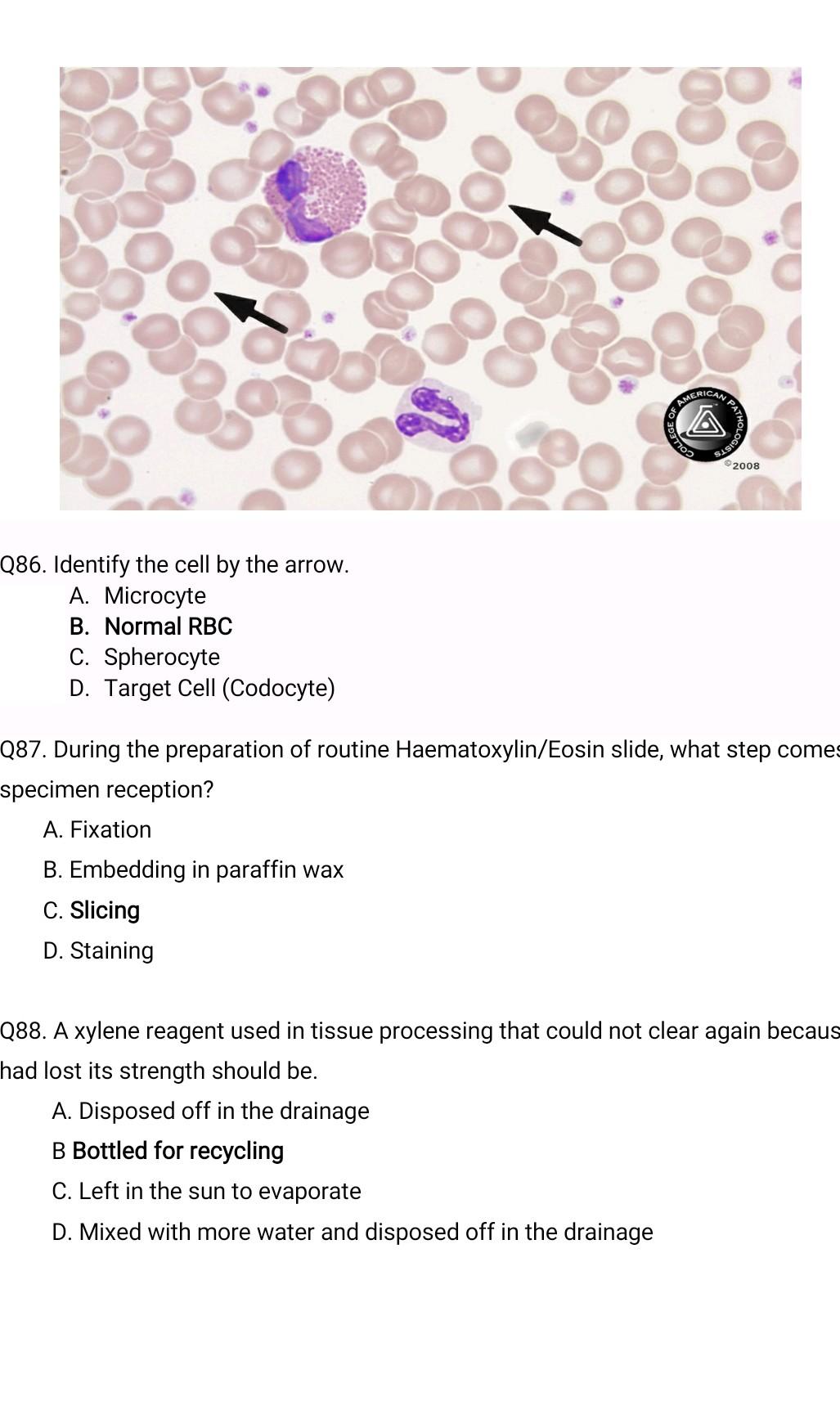 Solved Q86. Identify the cell by the arrow. A. Microcyte B. | Chegg.com