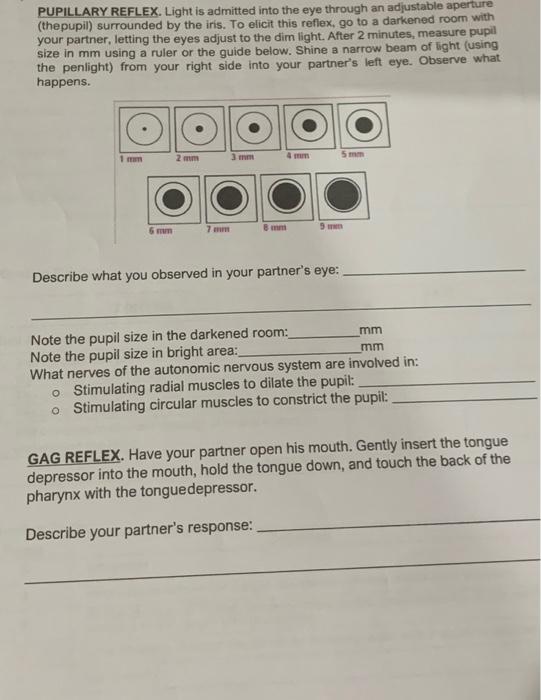 Solved PUPILLARY REFLEX. Light is admitted into the eye | Chegg.com