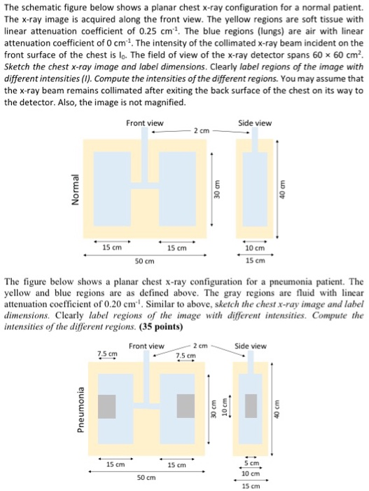 The schematic figure below shows a planar chest x-ray | Chegg.com