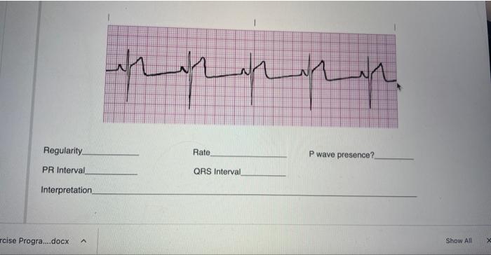 Regularity Rate P wave presence? PR Interval QRS | Chegg.com