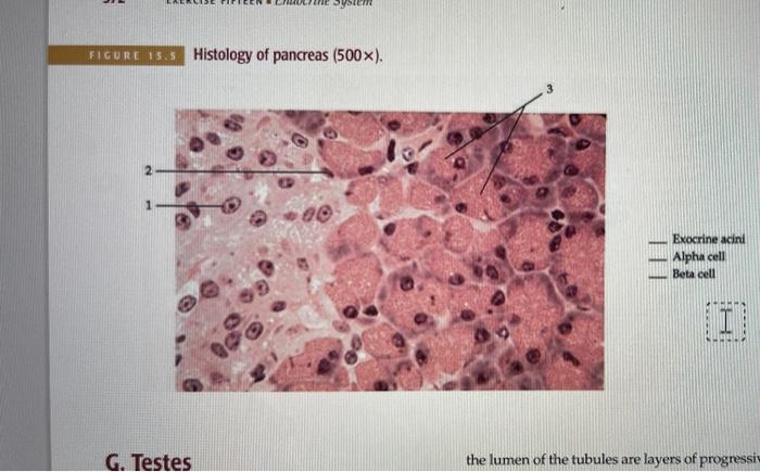 Solved System FIGURE 13.5 Histology of pancreas (500x). 3 | Chegg.com