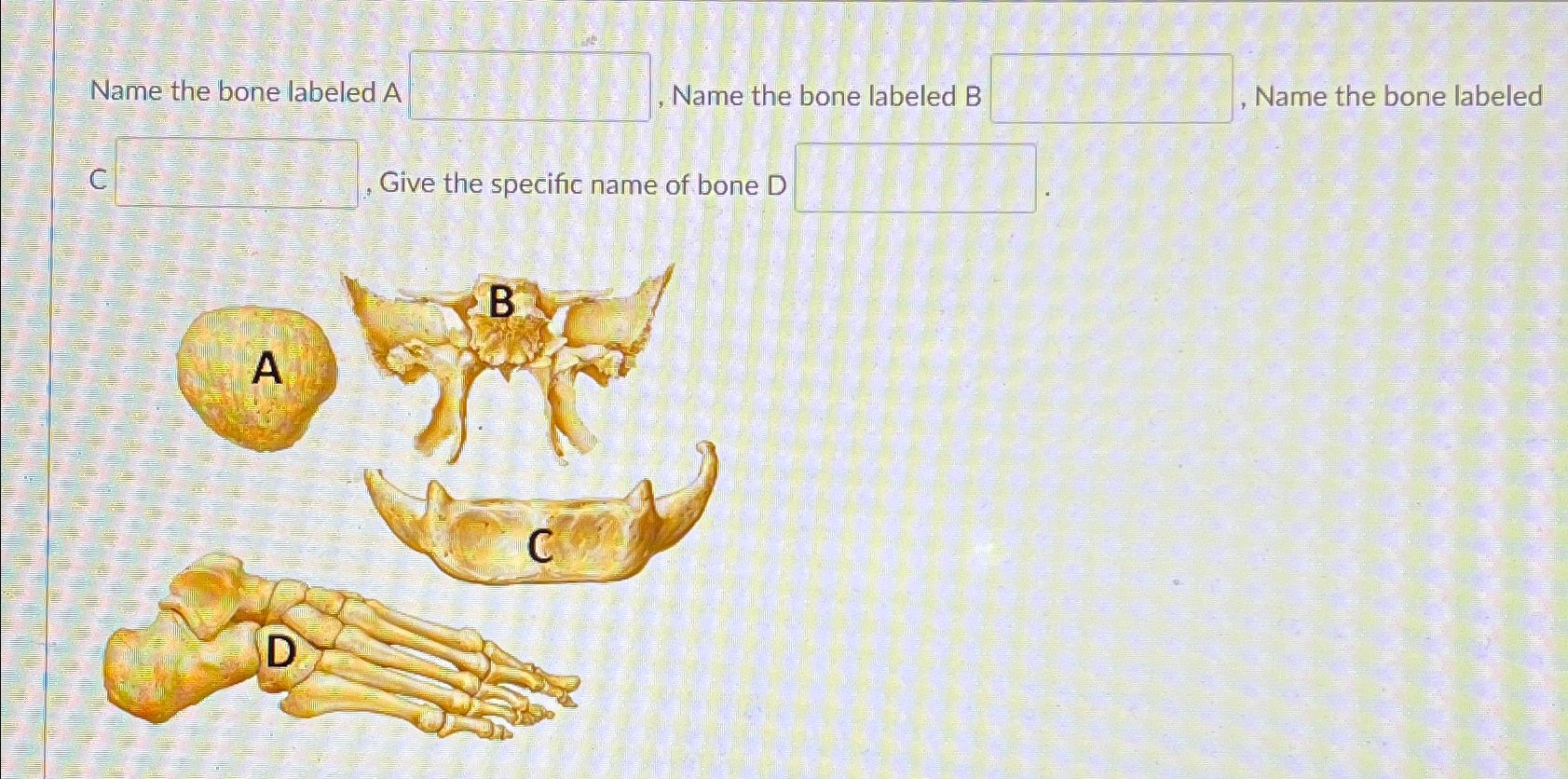 Solved Name the bone labeled AName the bone labeled BName | Chegg.com
