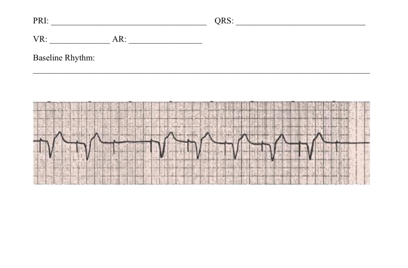 Solved PRI:QRS:VR:AR:Baseline Rhythm: | Chegg.com