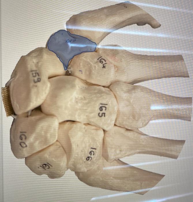 Solved Lunate Capitate Scaphoid Trapezoid Trapezium | Chegg.com