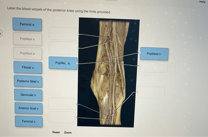 Solved Help Label the blood vessels of the posterior knee | Chegg.com