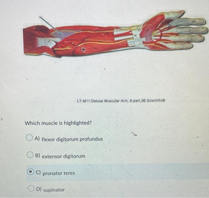 [Solved]: LT-M11 Deluxe Muscular Arm. 6-part.3B Scientifice