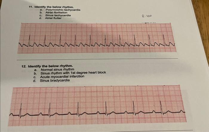 Solved 11. Idontify the bolow rhythm. a. Polymorphic | Chegg.com