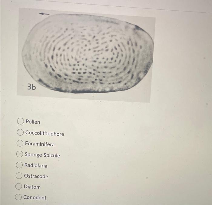 Identify the microfossil pictured below. Foraminifera | Chegg.com