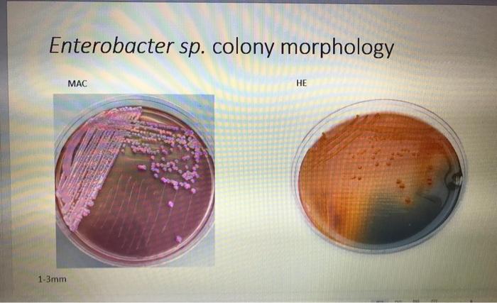 Solved Escherichia coli colony morphology HE MAC 1-5mm | Chegg.com