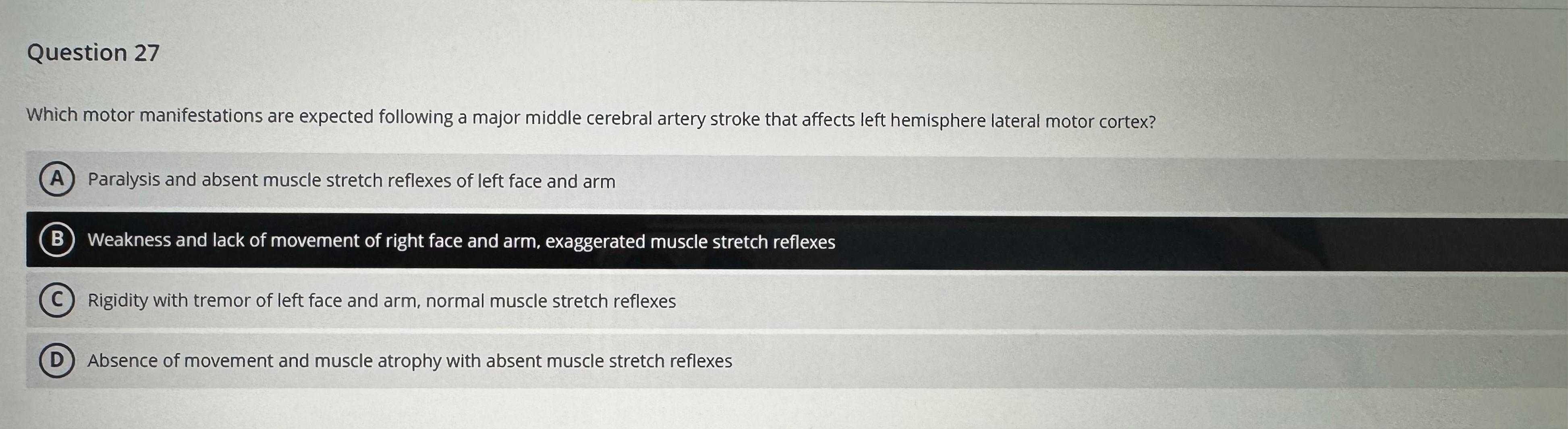 Solved Question 27Which motor manifestations are expected | Chegg.com