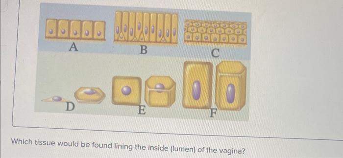 Solved Which tissue would be found lining the inside (lumen) | Chegg.com