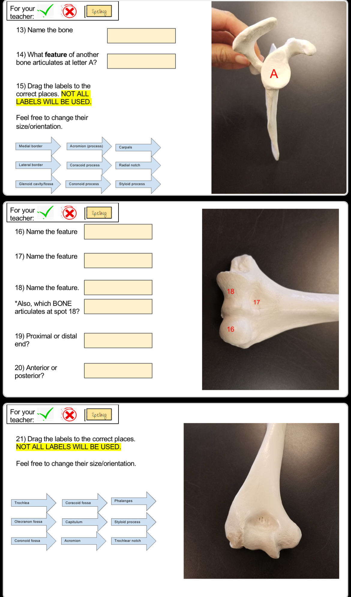 Solved For yourteacher:Name the boneWhat feature of another | Chegg.com