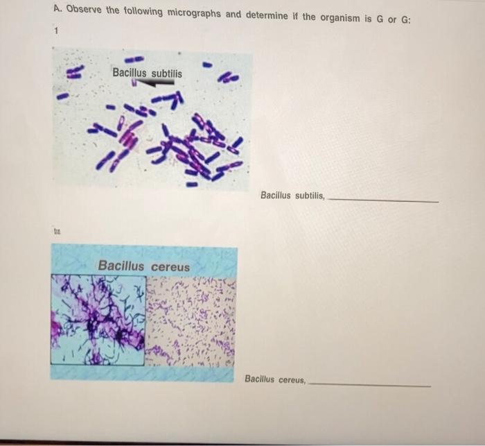 Bacillus Subtilis Microscope