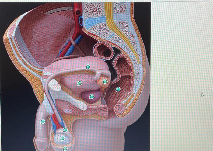 Solved label | Chegg.com