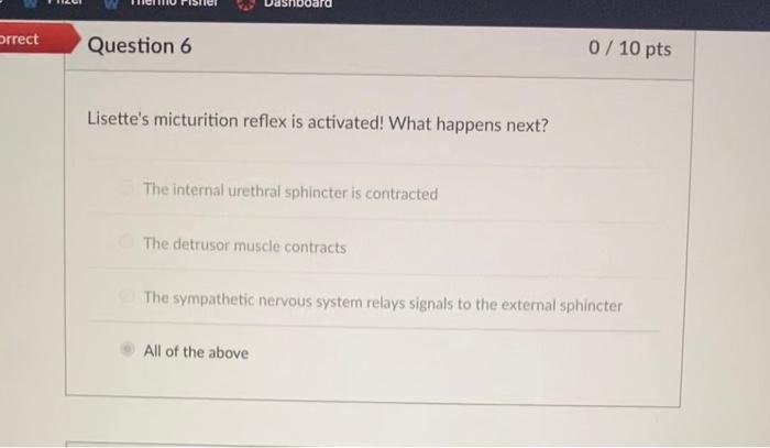 Solved Lisette's micturition reflex is activated. what | Chegg.com