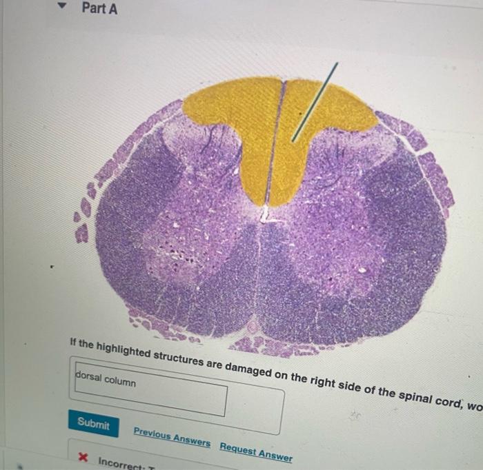 Solved PAL: Histology > Nervous Tissue > Lab Practical > | Chegg.com