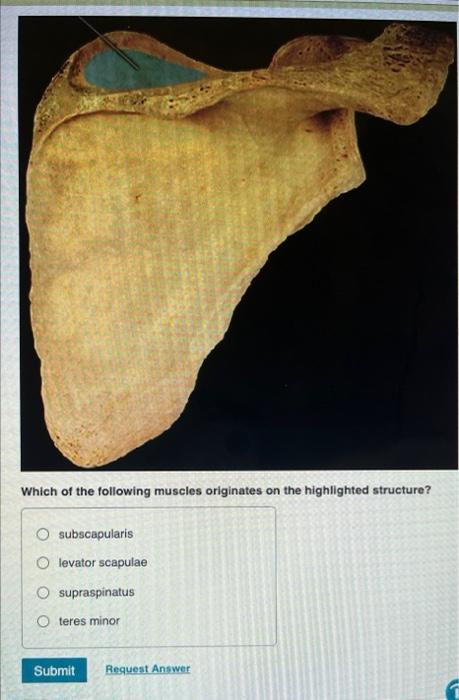 Solved Which surface is highlighted? O supraspinous fossa O | Chegg.com