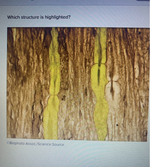 Solved Which structure is highlighted? Biophoto | Chegg.com
