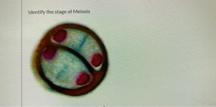 Solved Identify the stage of Meiosis | Chegg.com