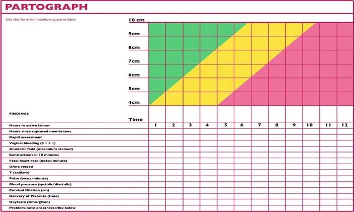 Solved Case 5: Lourdes, G4P2 was admitted at 1 pm today due | Chegg.com