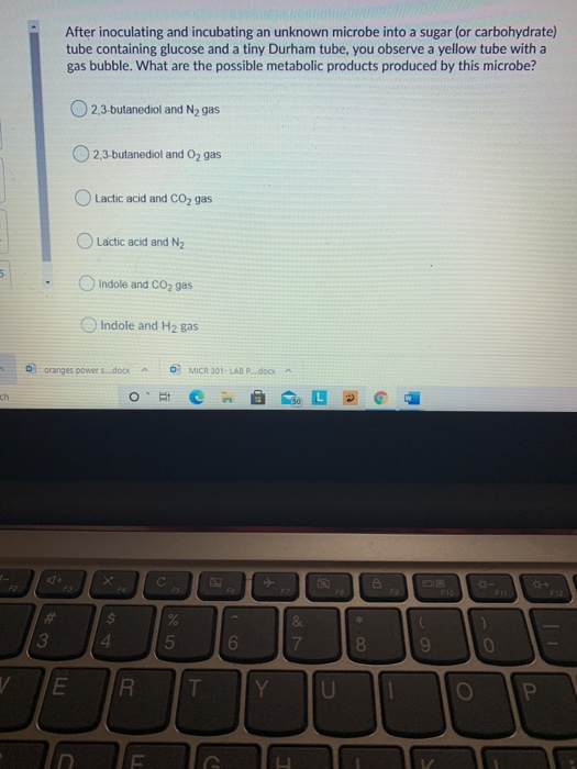 Solved After inoculating and incubating an unknown microbe | Chegg.com