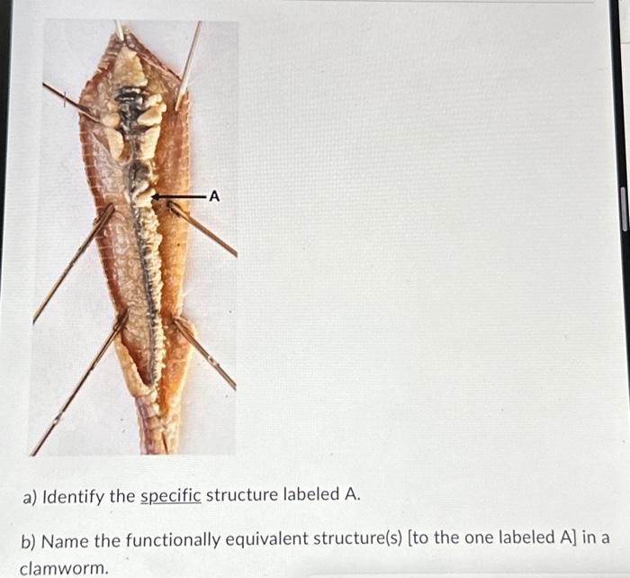 Solved -A a) Identify the specific structure labeled A. b) | Chegg.com Solved -A a) Identify the specific structure labeled A. b) | Chegg.com