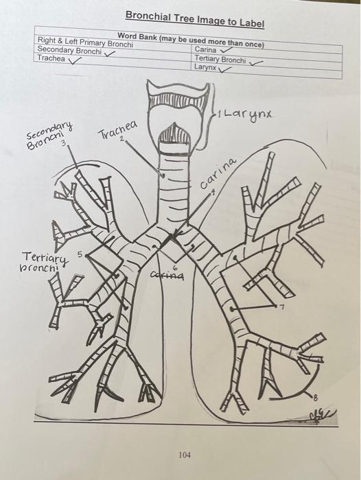 Solved Alveoli Image to Label Alveolus Alveolar Duct Venule | Chegg.com