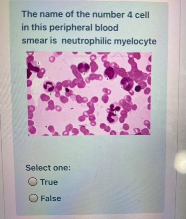 Solved All smears from anticoagulated EDTA blood should be | Chegg.com