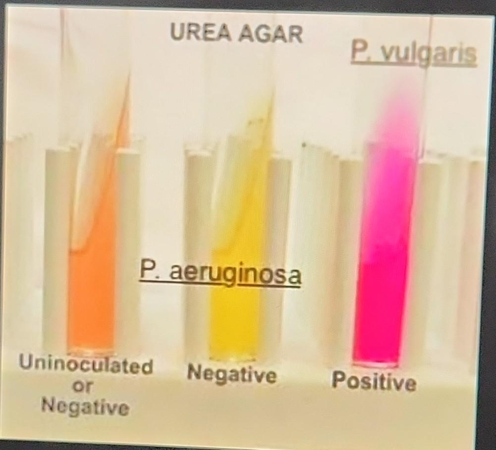 Urea Agar