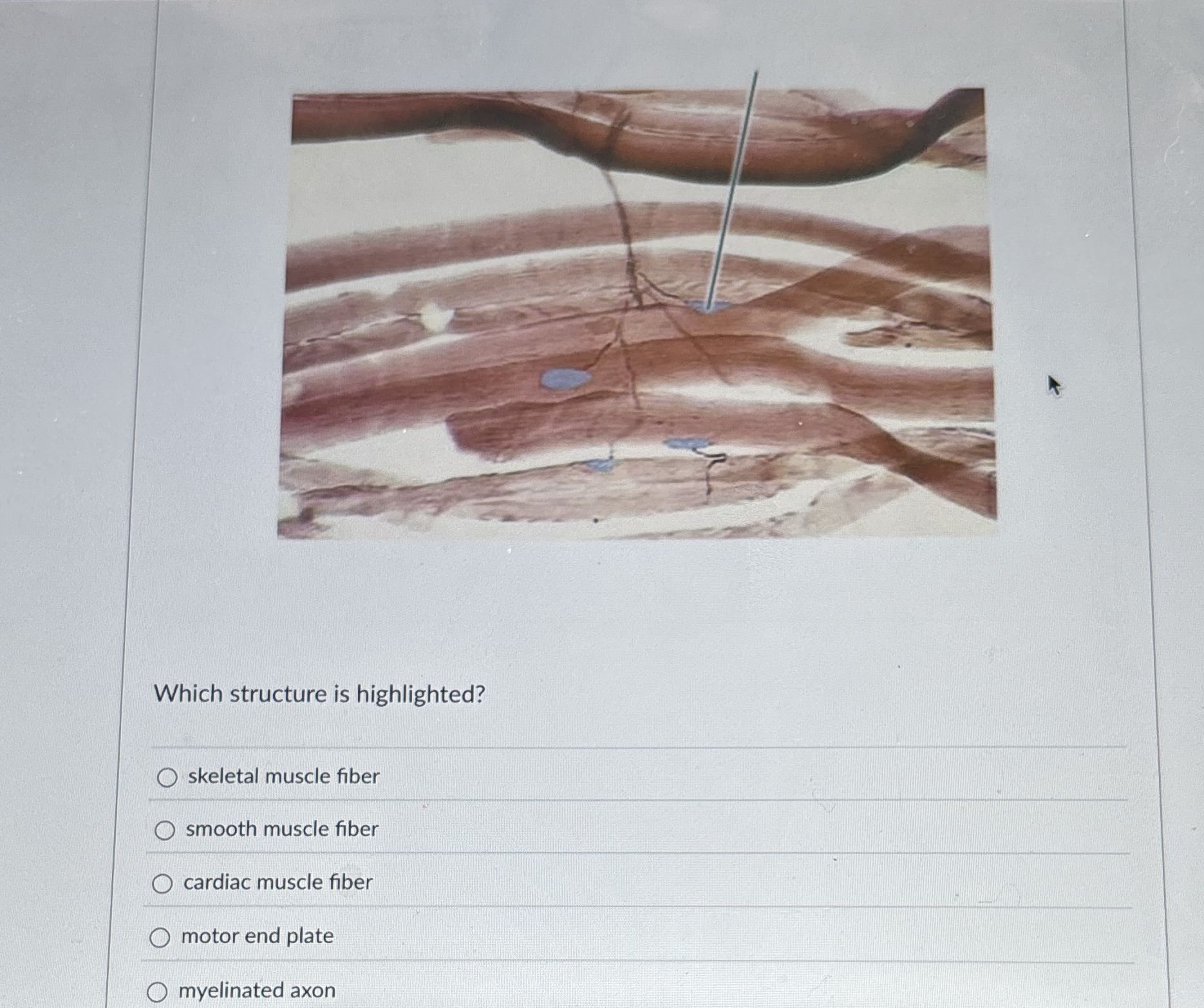 Solved Which structure is highlighted?q,skeletal muscle | Chegg.com