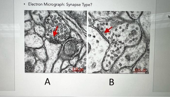 Solved Electron Micrograph: Synapse Type? A B 25 une | Chegg.com