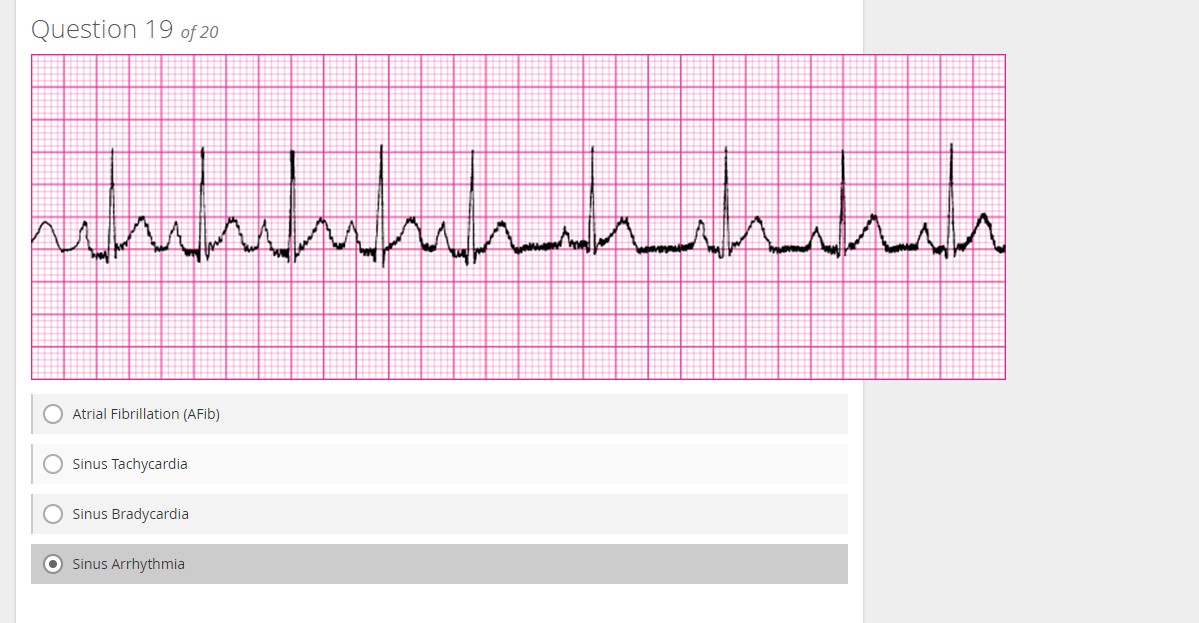 Solved Question 19 ﻿of 20Atrial Fibrillation (AFib)Sinus | Chegg.com