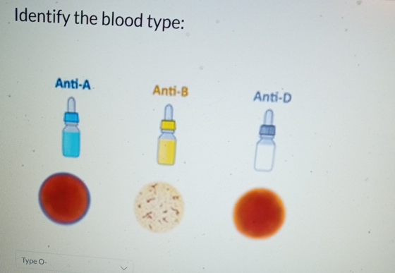 Solved 52 ﻿pointsIdentify the blood | Chegg.com