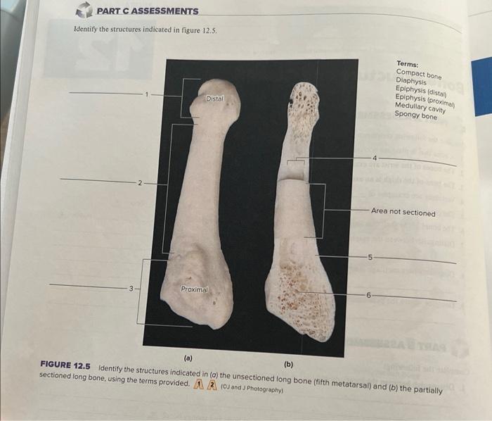 Solved Bone Structure and Classification PART A ASSESSMENTS | Chegg.com
