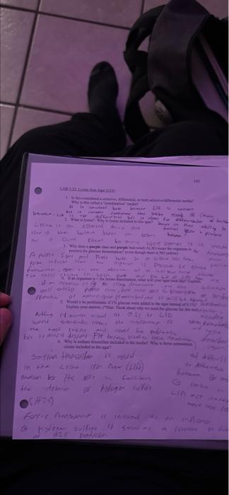 Solved It Is bacteria. LiA IS And 1+ 7150 1 One of Lysine is | Chegg.com