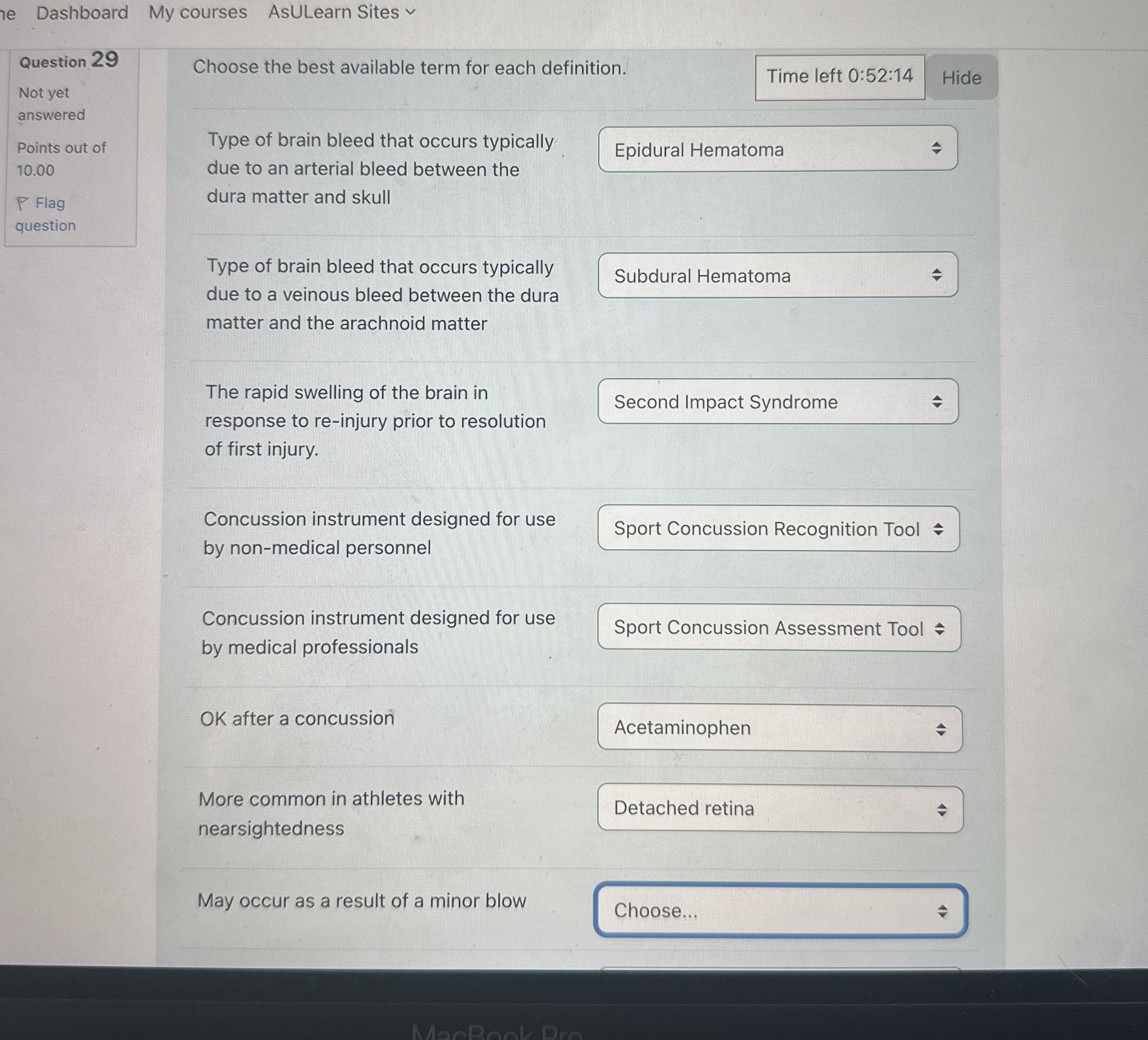 Solved DashboardMy coursesAsULearn SitesQuestion 29Not yet | Chegg.com