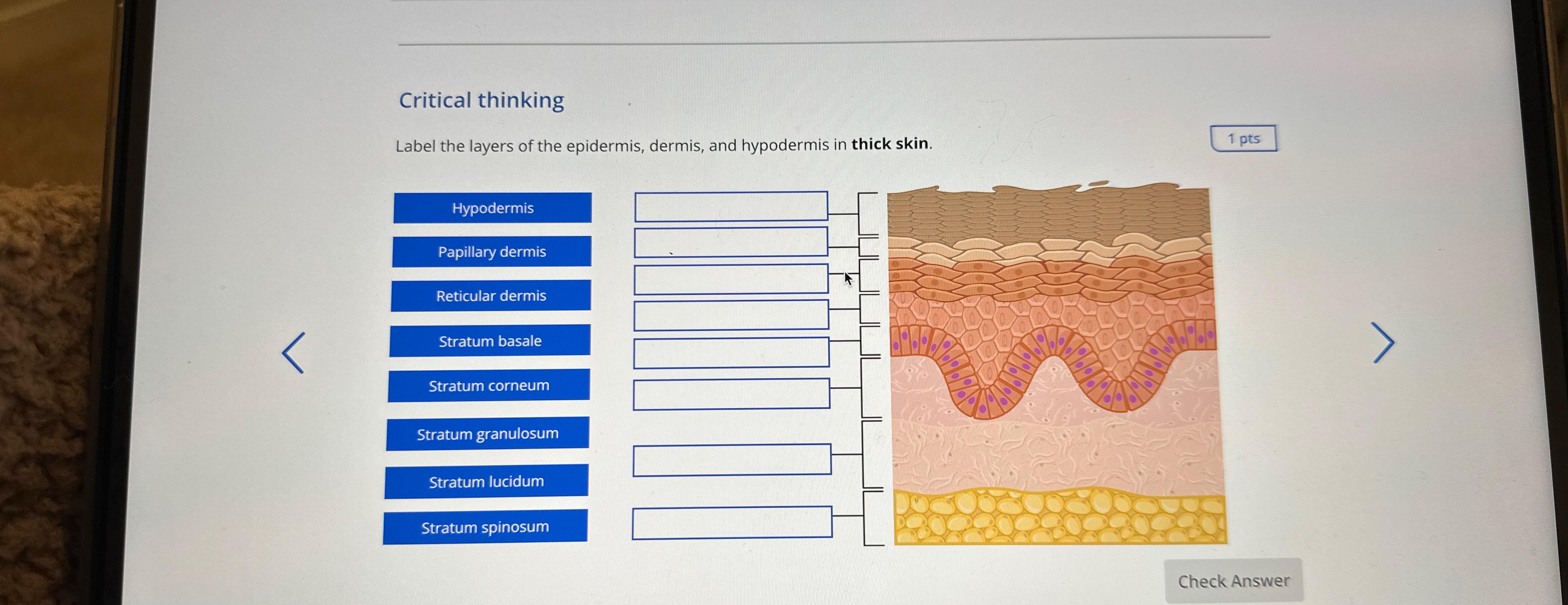 Solved Critical thinkingLabel the layers of the epidermis, | Chegg.com