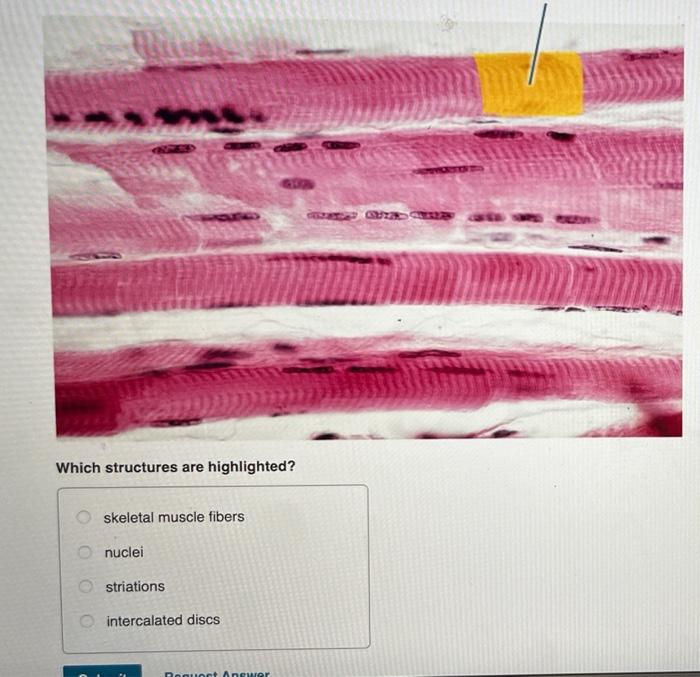 Solved What is an action of the highlighted muscle at the | Chegg.com