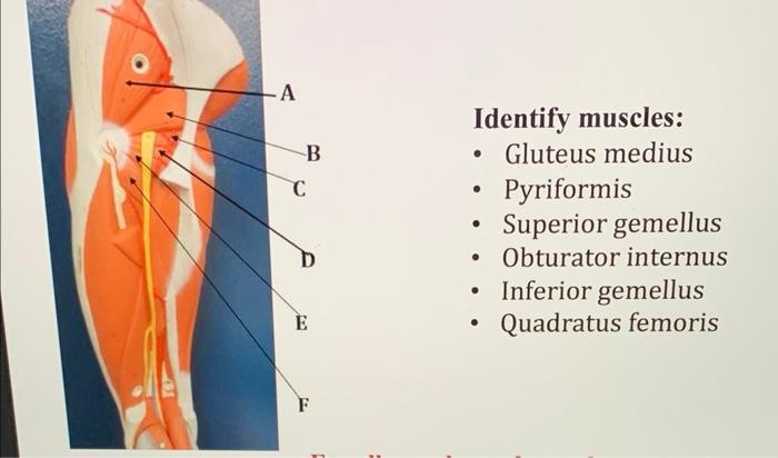 Solved Identify muscles: - Gluteus medius - Pyriformis - | Chegg.com