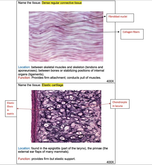 Solved + Name the tissue: simple columnar epithelium nuclei | Chegg.com