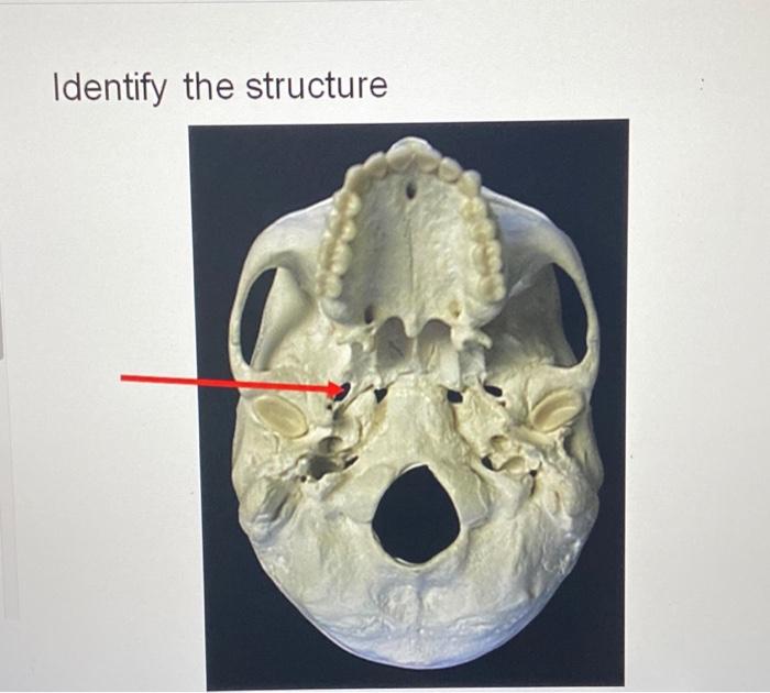 Solved Identify the structure Identify the structure | Chegg.com