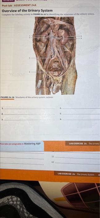 [Solved]: Post-lab ASSESSMENT 24A Overview of the Urinary S