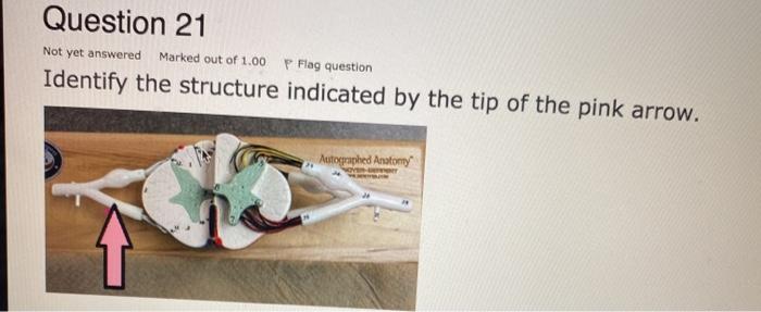 Solved Identify the structure indicated by the tip of the | Chegg.com