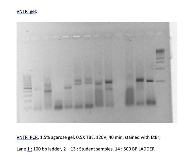 Solved VNTR PCR, 1.5% agarose gel, 0.5XTBE,120 V,40 min, | Chegg.com