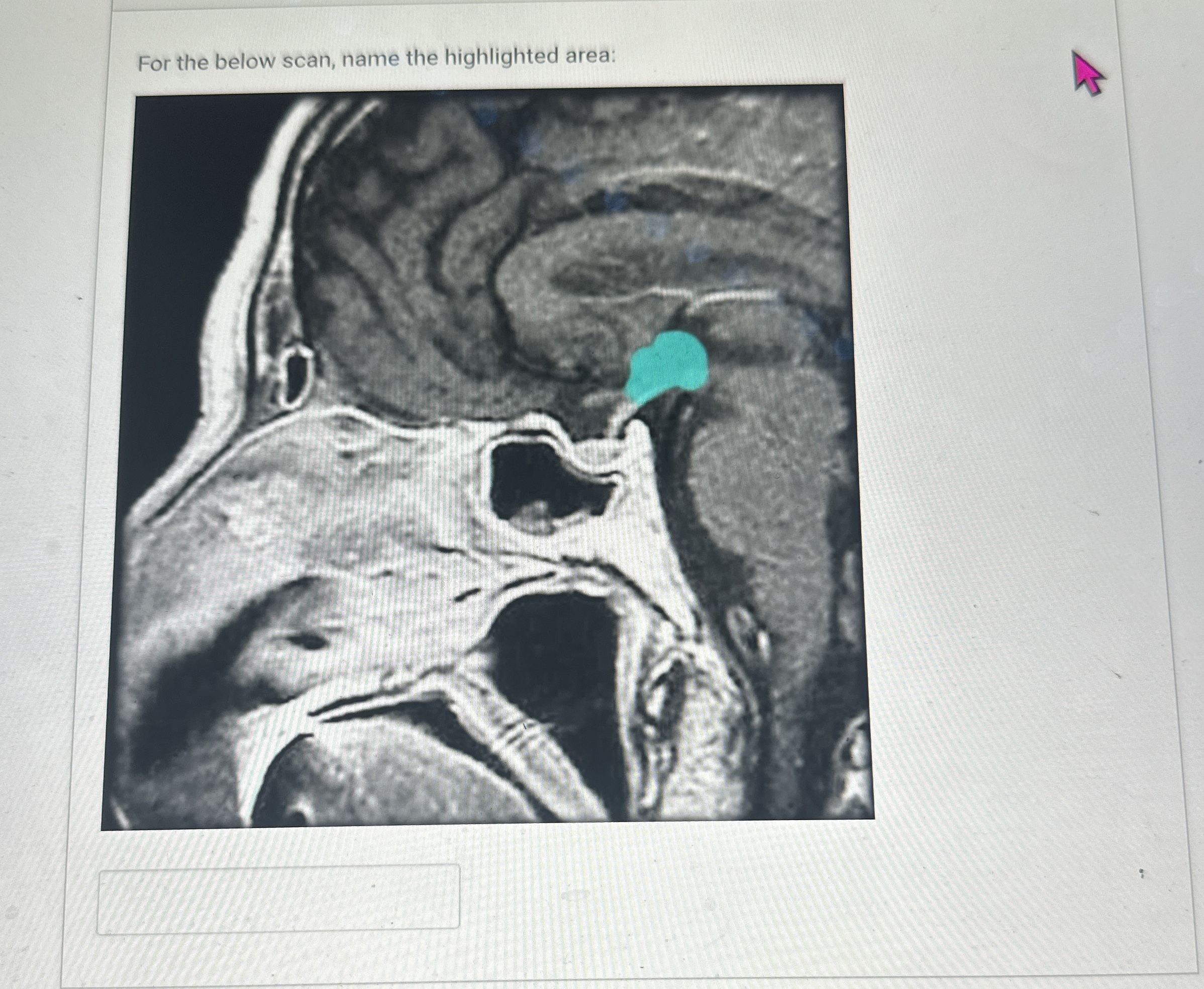 Solved For the below scan, name the highlighted area: | Chegg.com